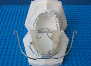 Kieferorthopädie (KFO) - Zahntechnik & Zahnmedizin mit Flemming Dental